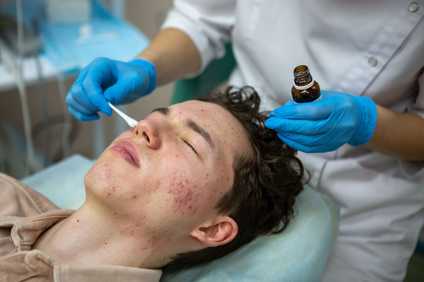 How to Combat Acne and Regain Confidence in Your Skin - Natur Skin